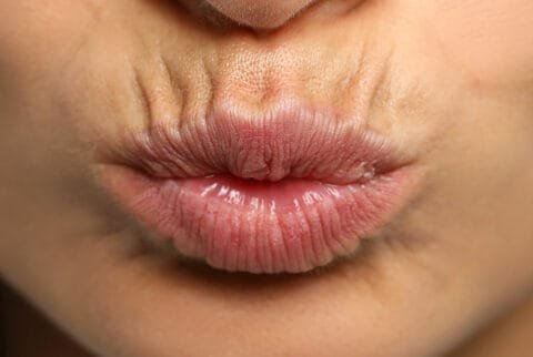 Arrugas del labio superior, consejos 100% útiles